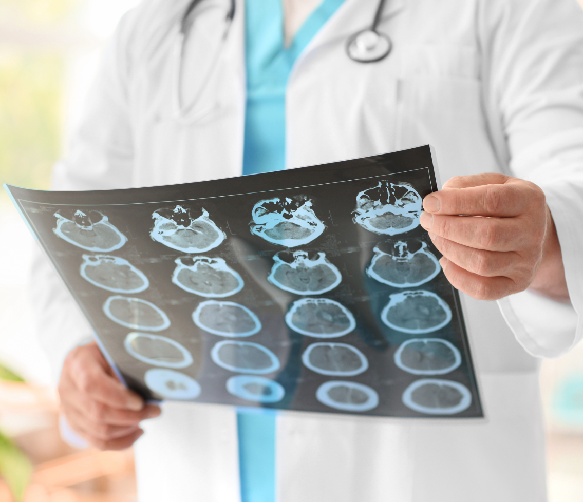 Neurologie Hradec Králové - MUDr. Helena Hojdíková